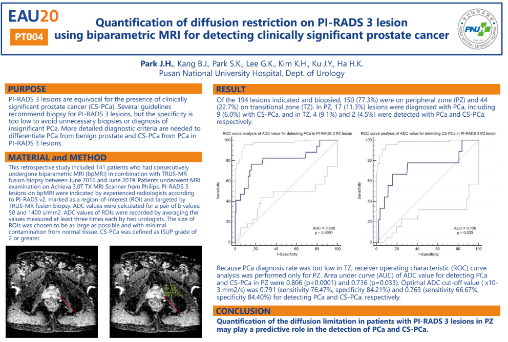 益普生直击2020 EAU丨前列腺癌mpMRI及穿刺活检最新进展_诊断