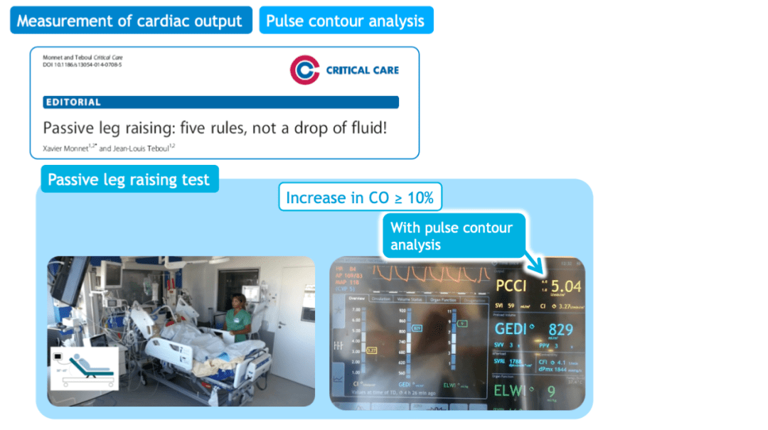 PiCCO在ICU中的应用_进行