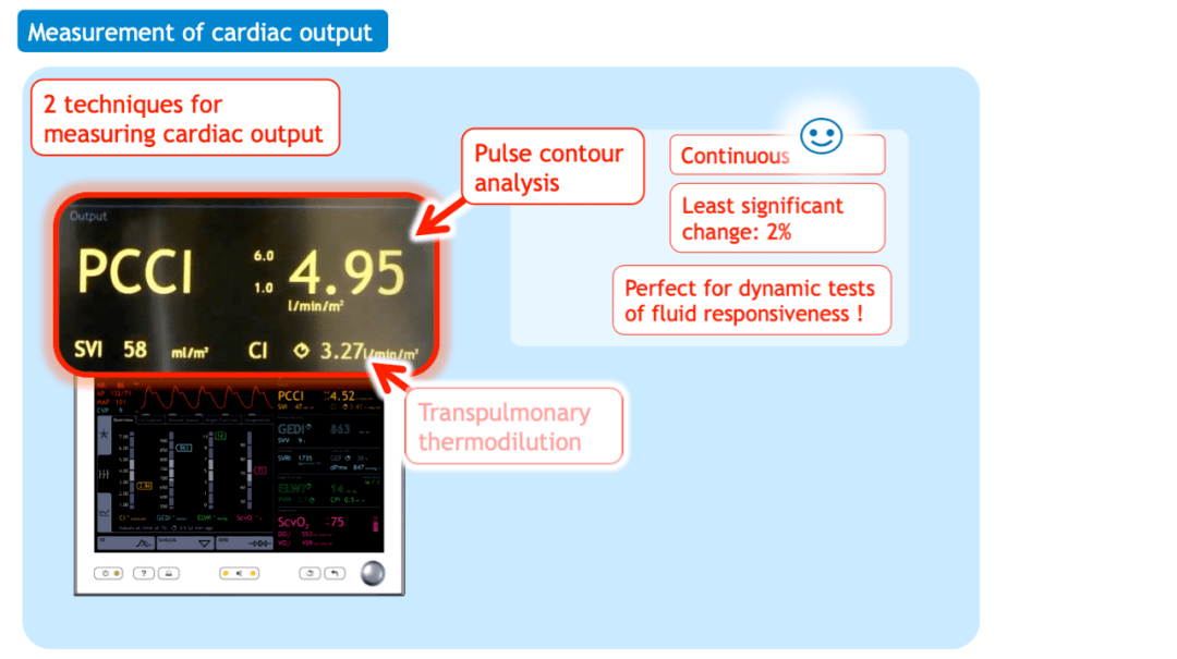 PiCCO在ICU中的应用_进行
