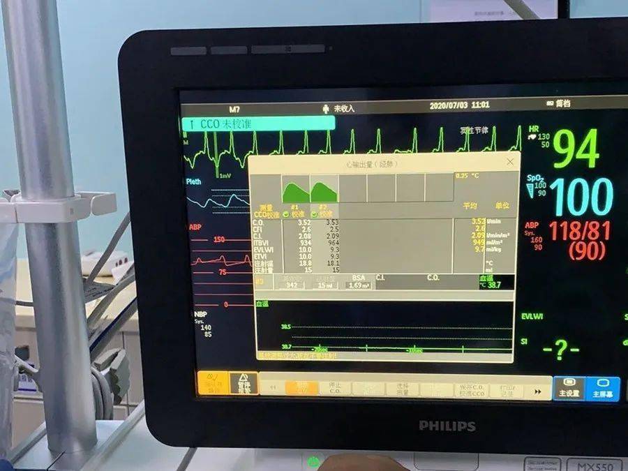 【科室动态】我院ICU开展PICCO监测新技术，重症救治能力再上新台阶！_患者