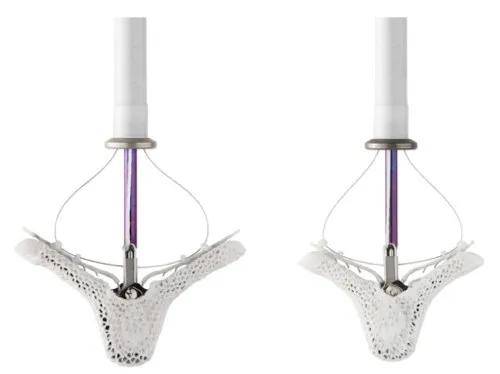 【权威发布】2020年最具创新性的18个医疗器械_stent