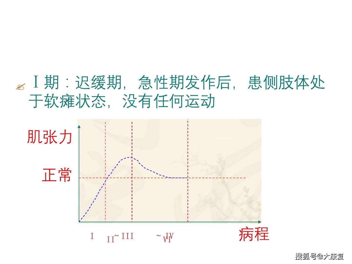 Brunnstrom技术_运动