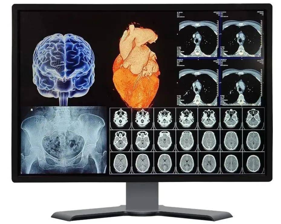 SID 2022：京东方、维信诺、天马、TCL华星、三星显示、LGD、友达、群创_技术_全球_产品