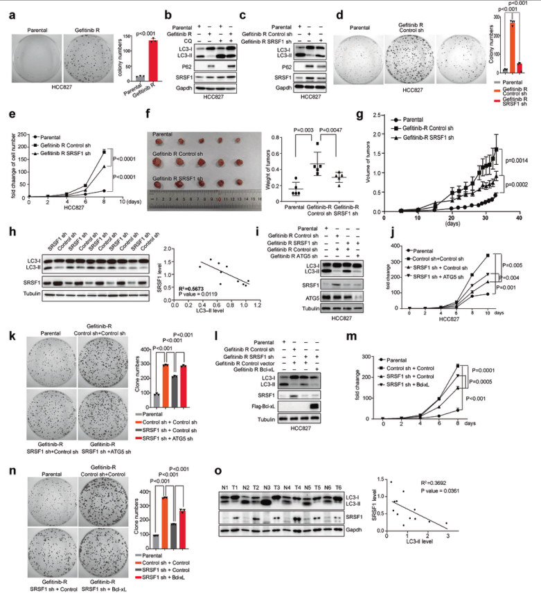 【SCI文献解读】SRSF1在肿瘤发生中的新调控作用_Bcl-x_调节_诱导