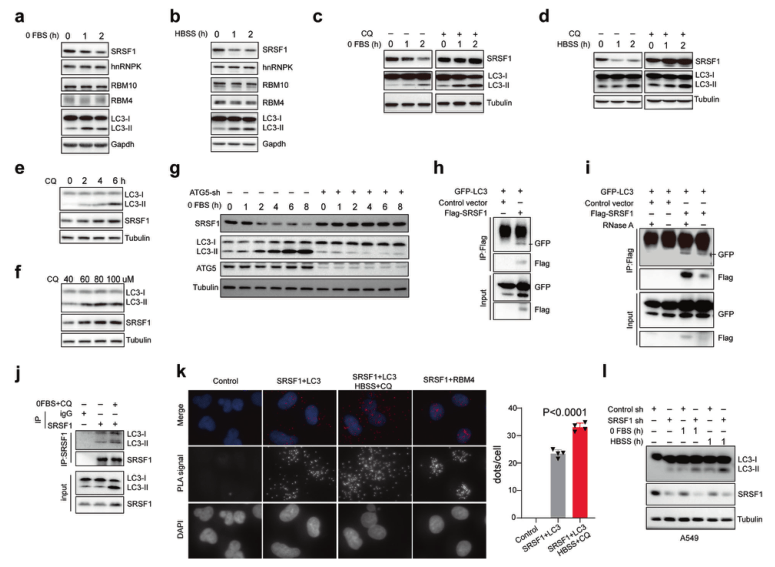 【SCI文献解读】SRSF1在肿瘤发生中的新调控作用_Bcl-x_调节_诱导