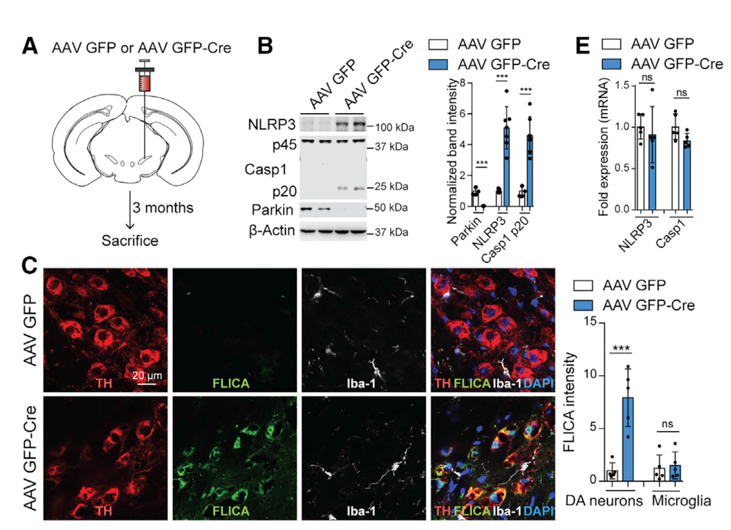 Neuron | NLRP3 -- 治疗帕金森病的新靶点_Hopkins_parkin_神经元