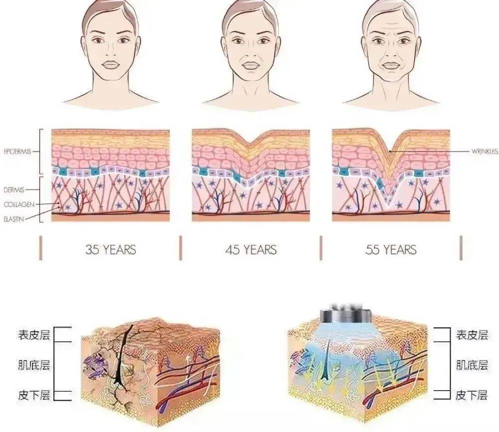 STSM深麦丨步履不停，坚定石墨烯美容探索_肌肤_人体_科学