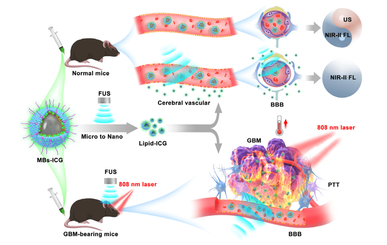 超声诱导血脑屏障开放的NIR-II荧光显像用于ICG微泡增强光热治疗胶质母细胞瘤_成像_方法_监测