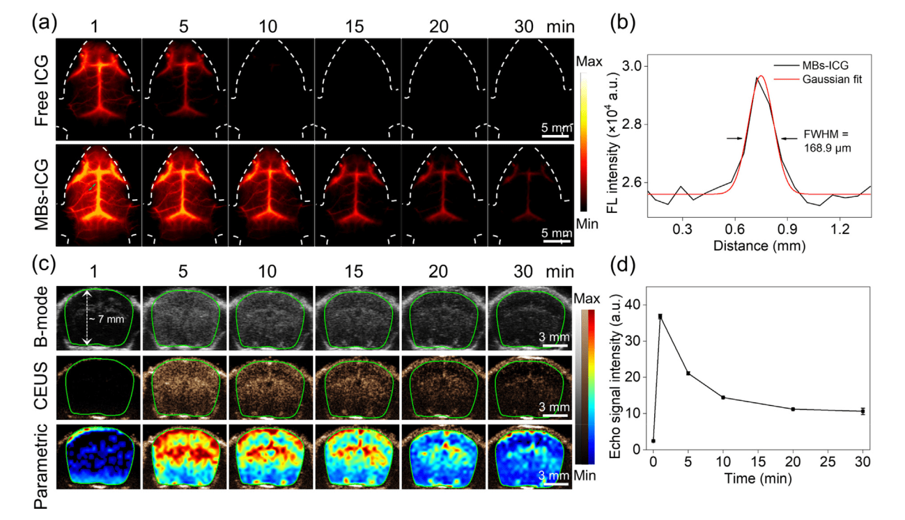 超声诱导血脑屏障开放的NIR-II荧光显像用于ICG微泡增强光热治疗胶质母细胞瘤_成像_方法_监测