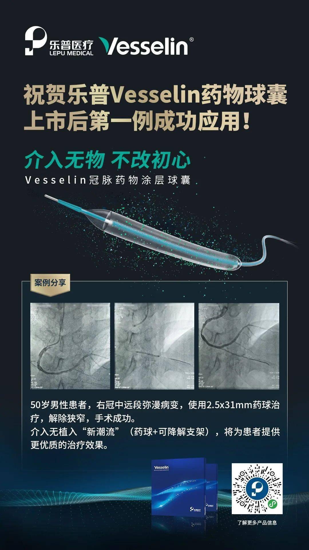 乐普医疗Vesselin药物球囊成功完成上市后首例临床应用_mm-