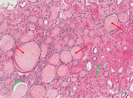 大鼠肾间质纤维化模型（UUO法）构建方法剖析_输尿管