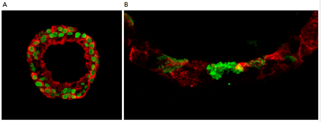 类器官研究又见刊 CNS，新冠患者的「替身」来了_Systems