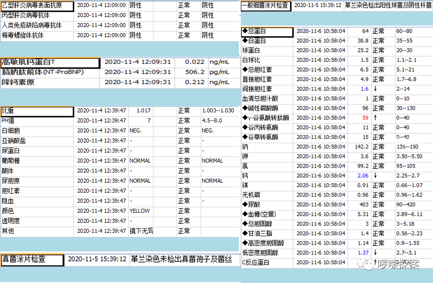 百闻不如一见，CT展示典型的DPB_双下