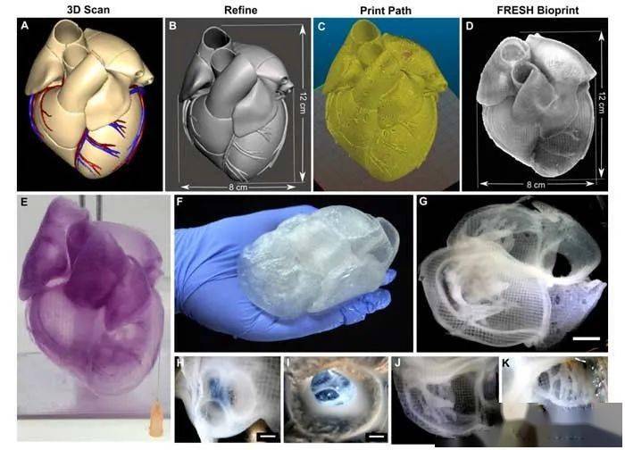 3D生物打印心脏技术——证明世界在变好的五件事_研究
