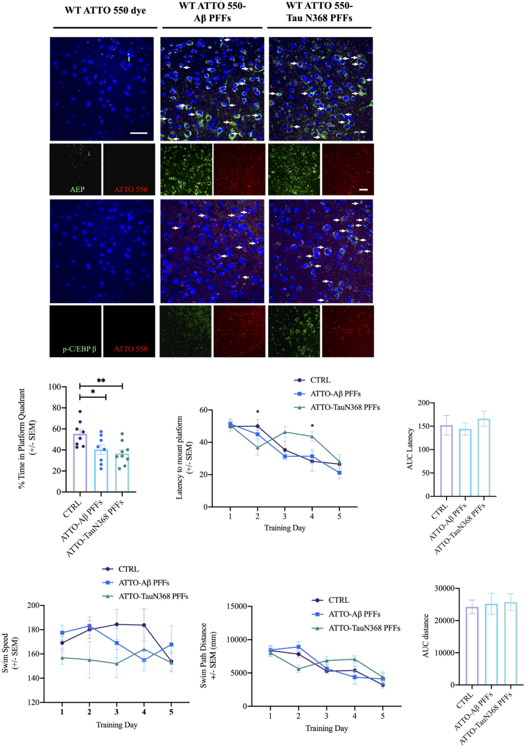 阿尔茨海默病毒蛋白由肠入脑！科学家发现，肠炎诱导的Aβ和Tau可由肠道经迷走神经进入大脑，进而引起AD相关症状及认知障碍_炎症