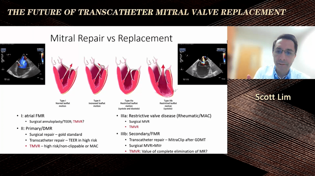 From Surgical to TMVR：二尖瓣介入置换距离临床广泛应用普及还有多远？_导管_Maisano_领域
