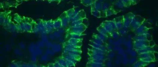 PEDV流行病学、发病机制及免疫预防_occurs_sows_as