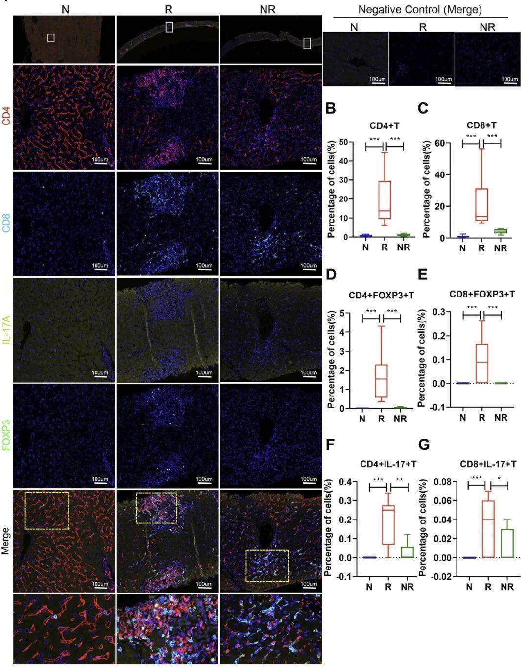肝移植组织微环境研究，多重荧光免疫组化有这些新发现！_反应_淋巴细胞_肝脏