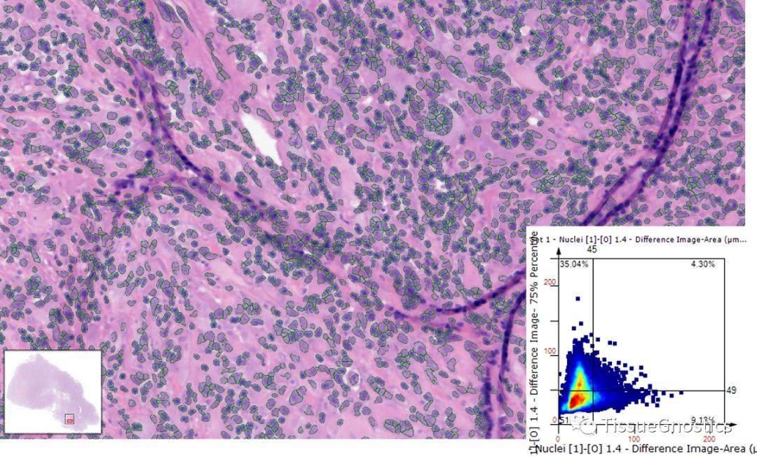 TissueGnostics公司H&E染色样本定量分析实例_识别_苏木_细胞核