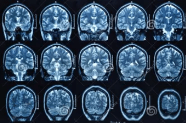 医院用什么设备拍片 ？DR、CT、MRI有什么区别_检查_辐射_诊断