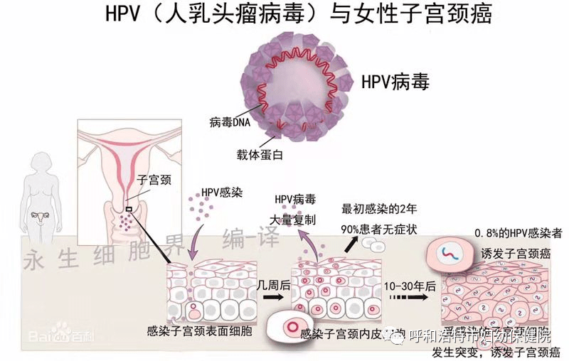 Hpv小科普病毒女性疫苗