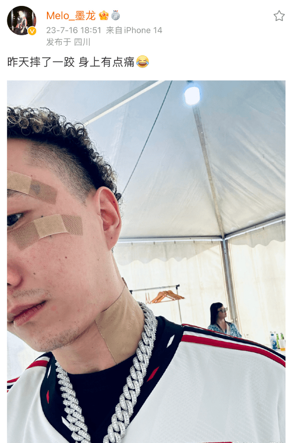 Melo这样化解了纹身问题！就是有点痛！_巅峰_西蒙_回应